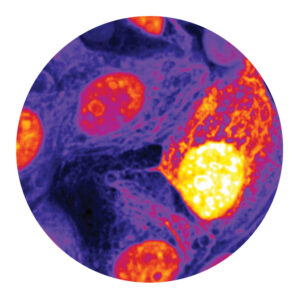 Aimee Edinger Destroys Cancer Cells - UCI Beall Applied Innovation